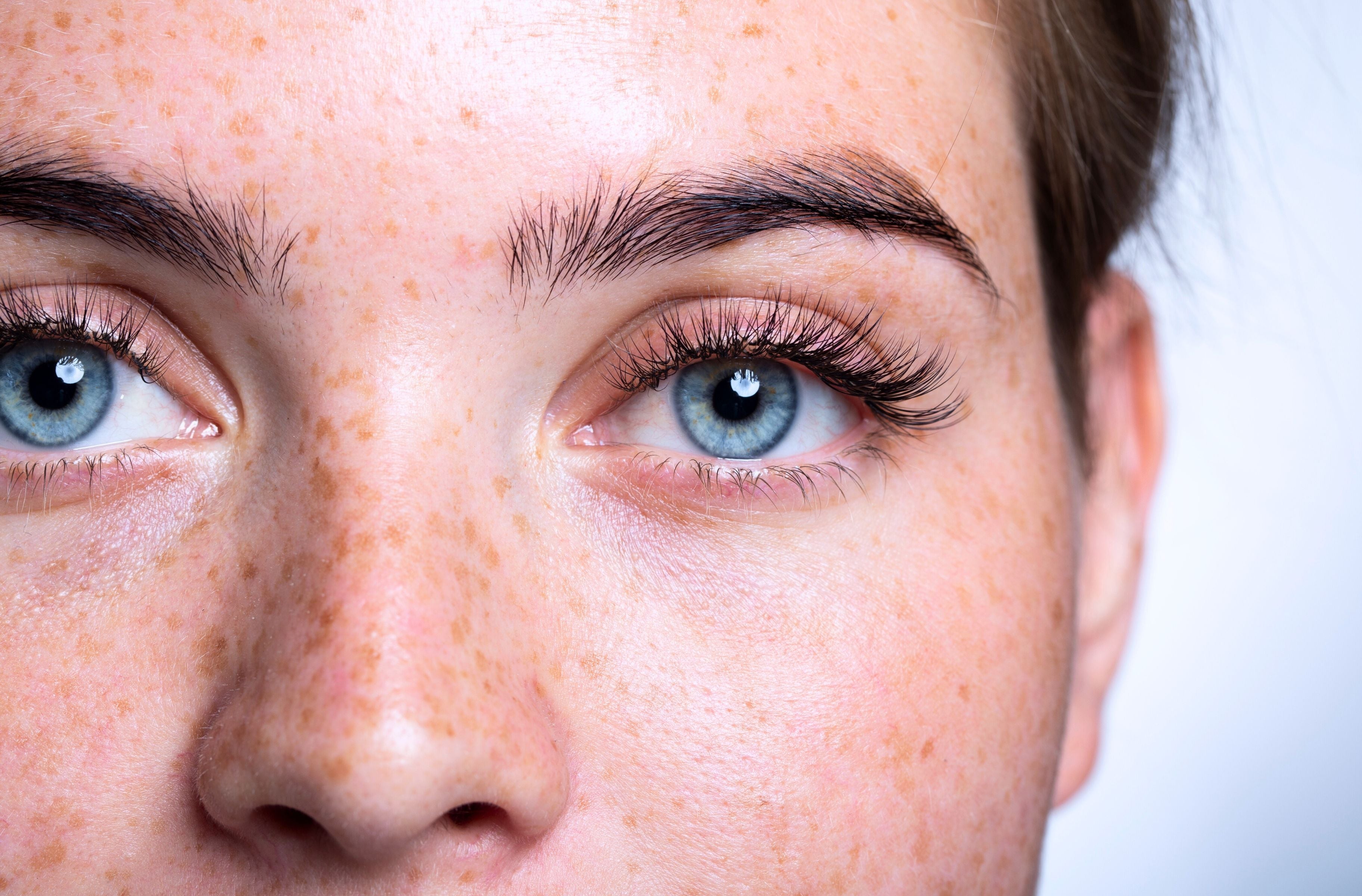 L’origine des yeux bleus – Iris