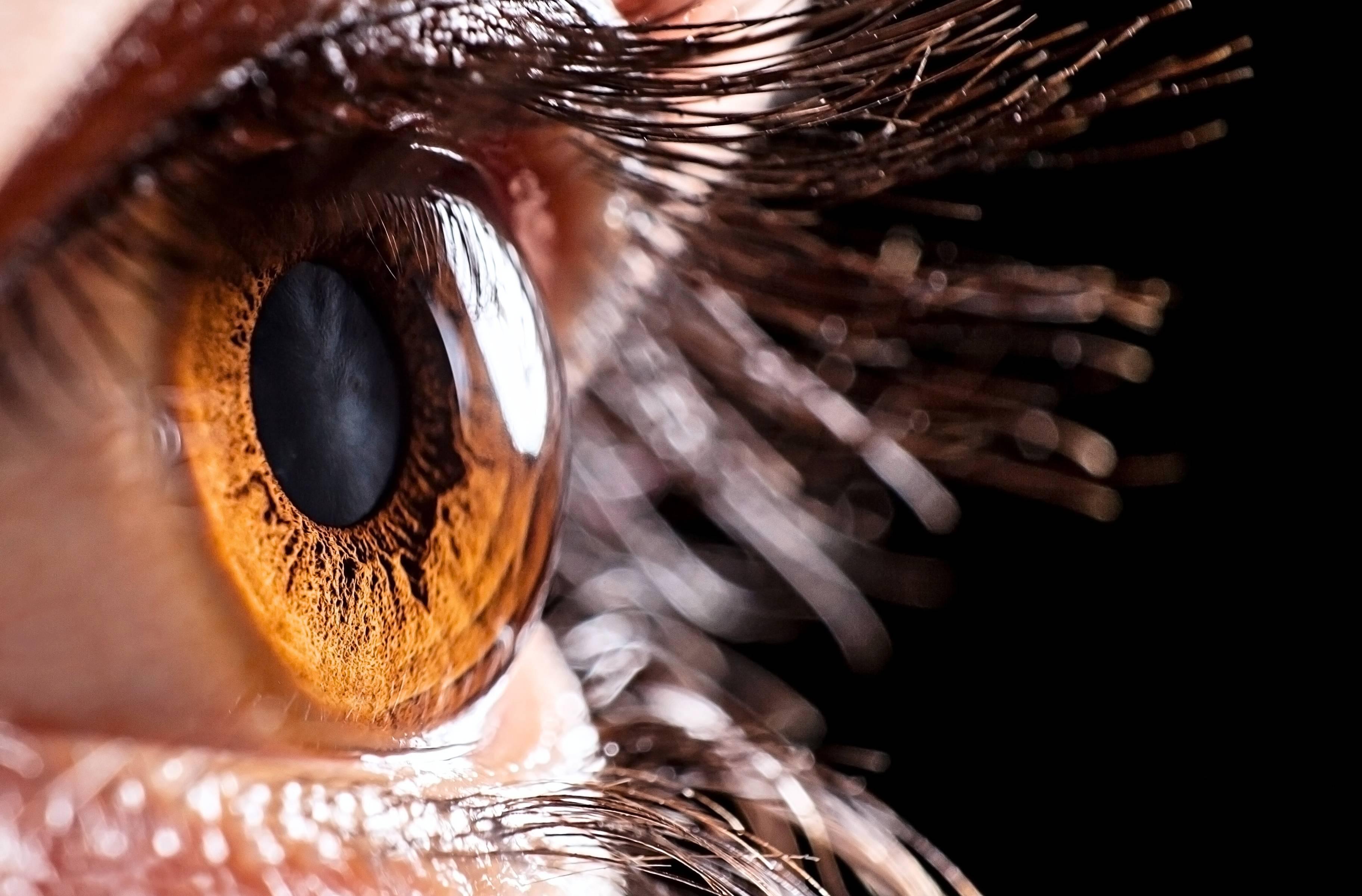 La cornée. Qu’est-ce que c’est ? – Iris