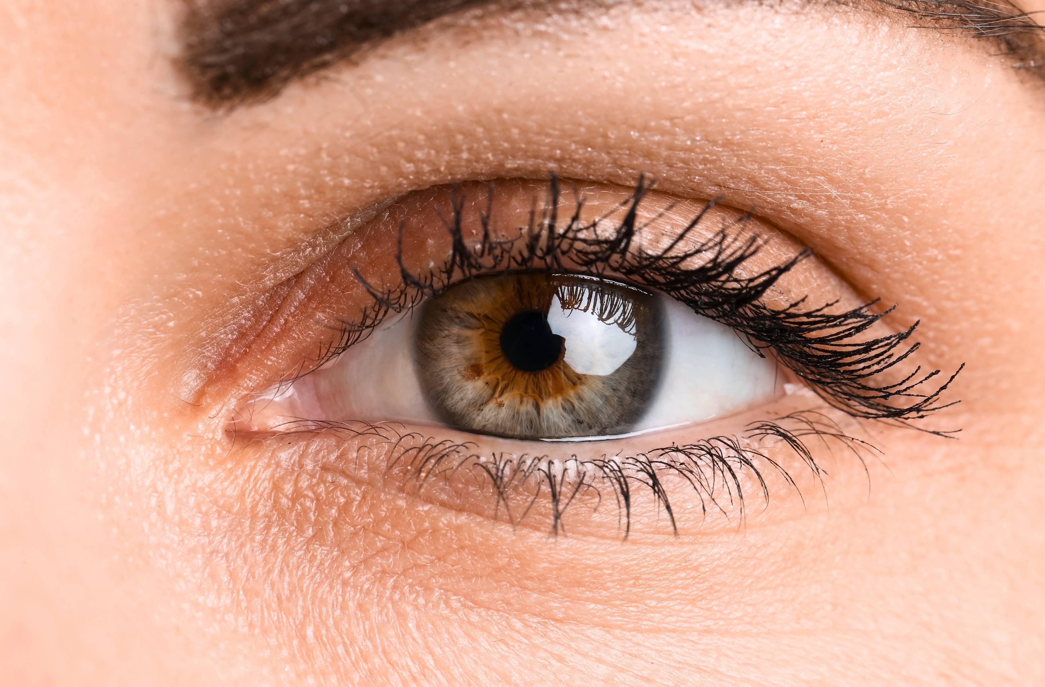 Hazel Eyes: How to explain mismatched eyes? – Iris