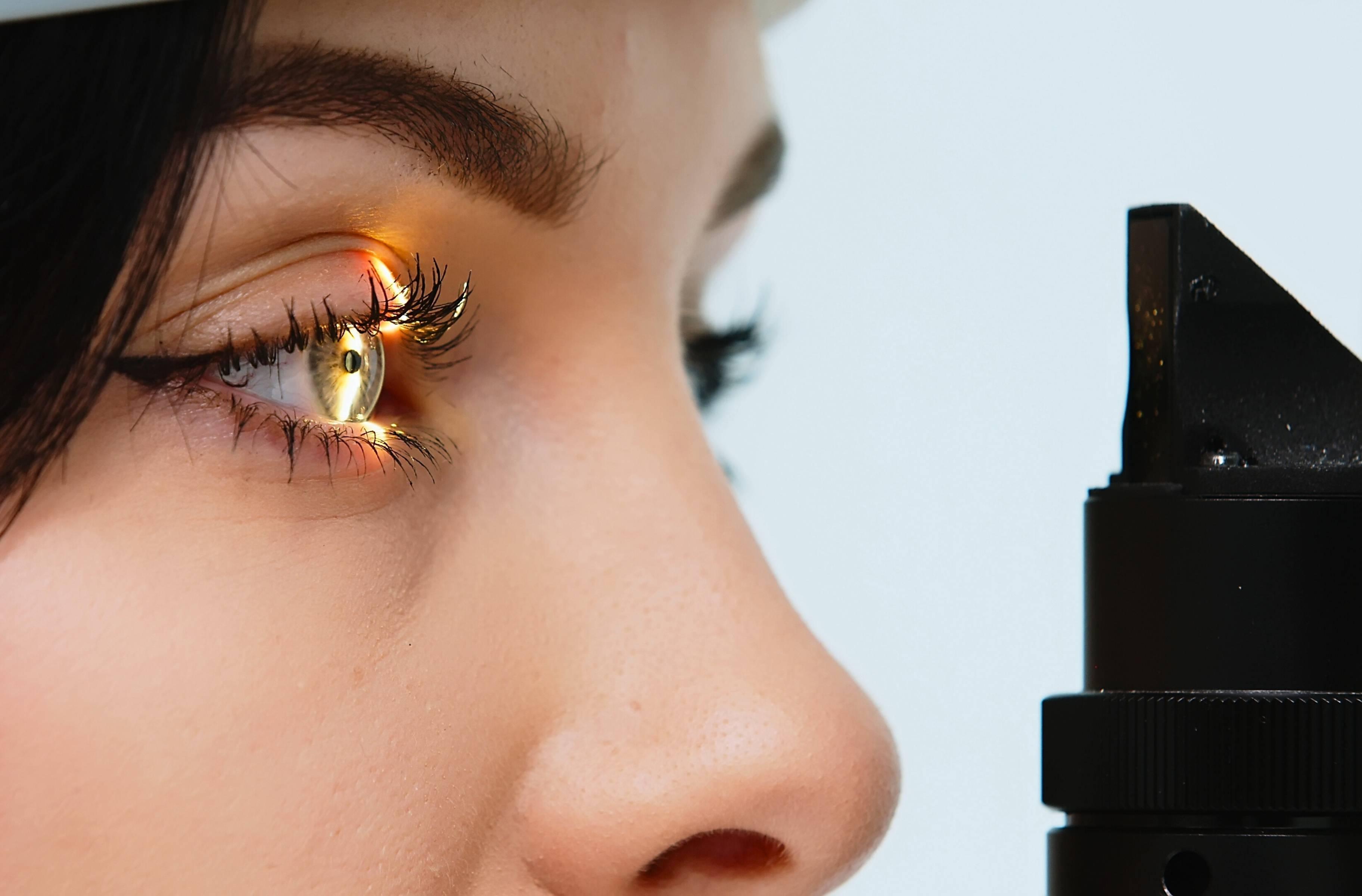 What is retinal detachment? – Iris