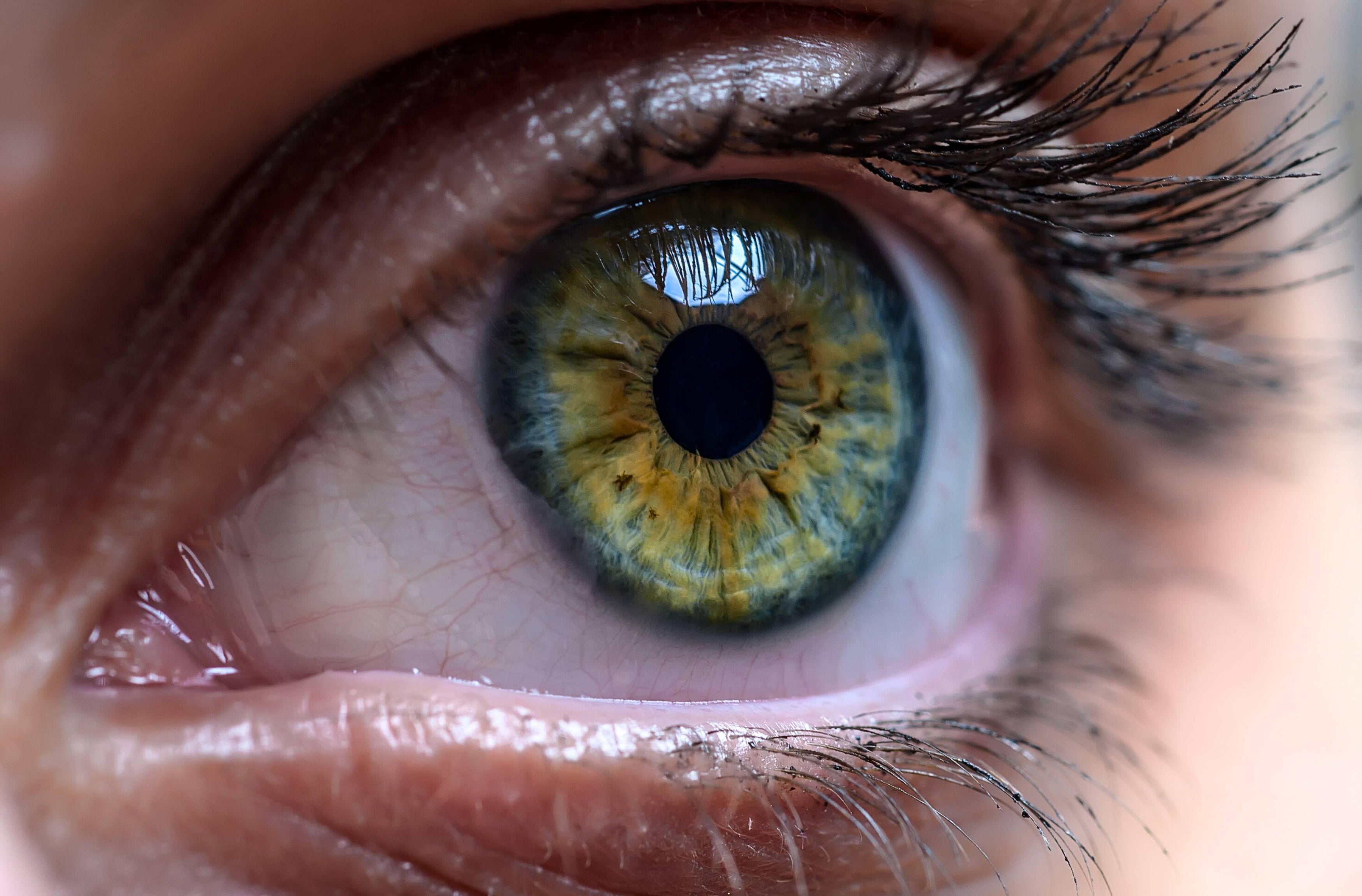 Yeux verts : La couleur la plus rare? – Iris
