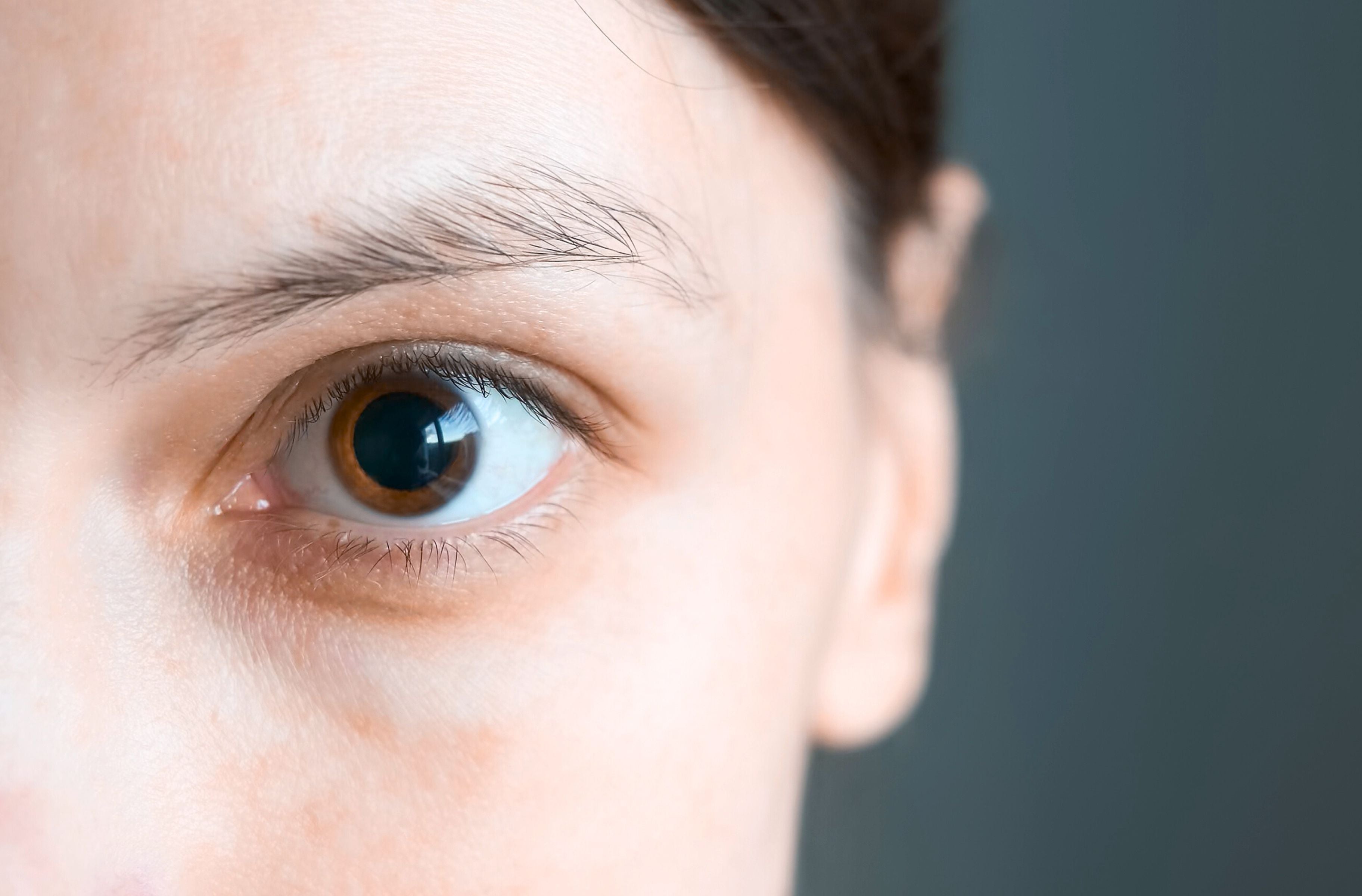 Dilated Pupils: Causes, Concerns and Treatment – Iris
