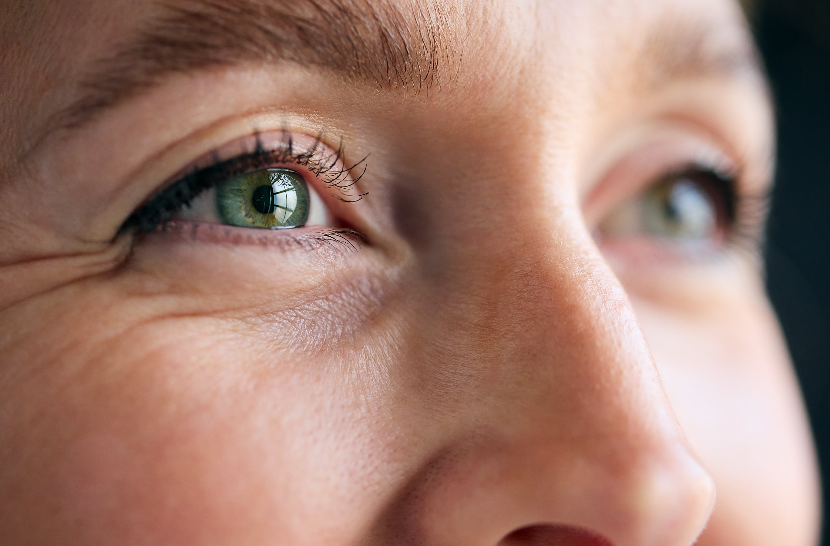 What Are the Early Symptoms of Cataracts? – Iris